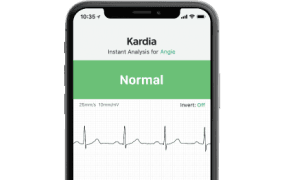 Products | AliveCor India