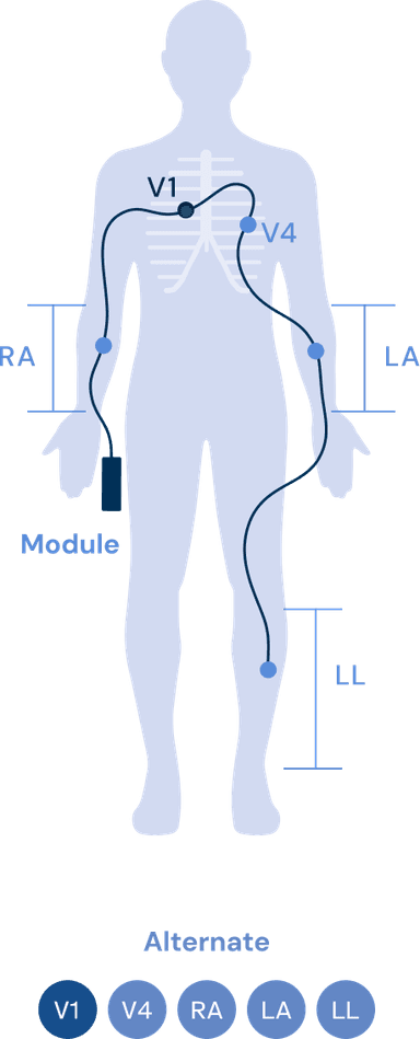 12-Lead Portable ECG Device in India - Kardia 12L | AliveCor India