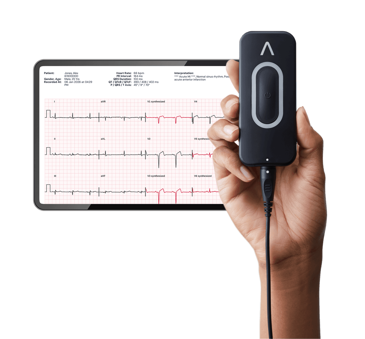 AliveCor | AliveCor Home