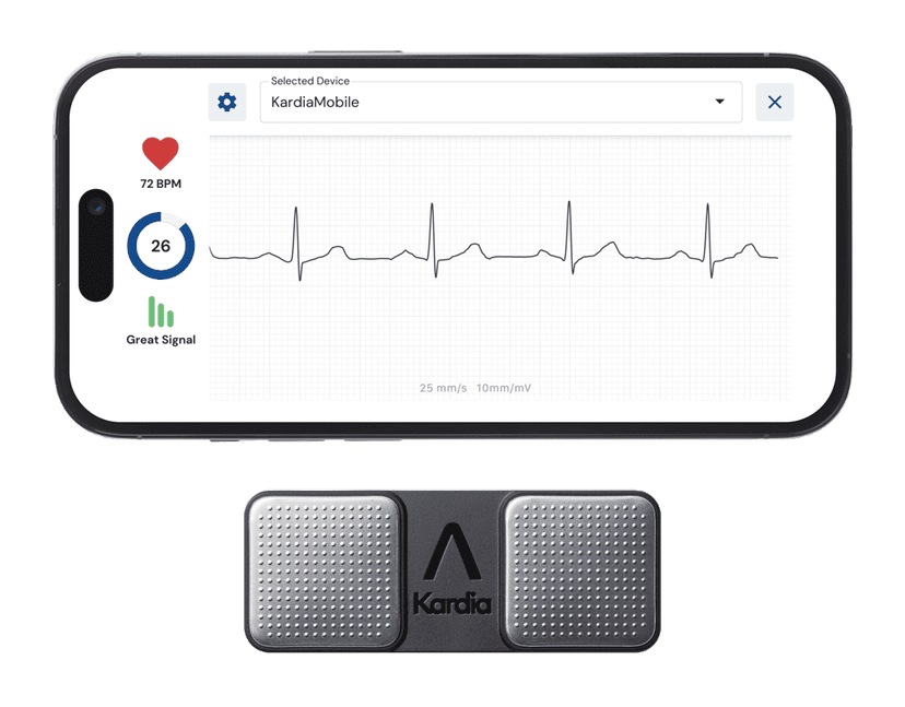 KardiaMobile: Personal Single-Lead ECG Device| AliveCor India | US FDA ...